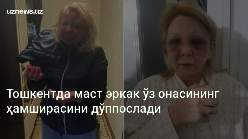 Тошкентда маст эркак ўз онасининг ҳамширасини дўппослади - UzNews.uz